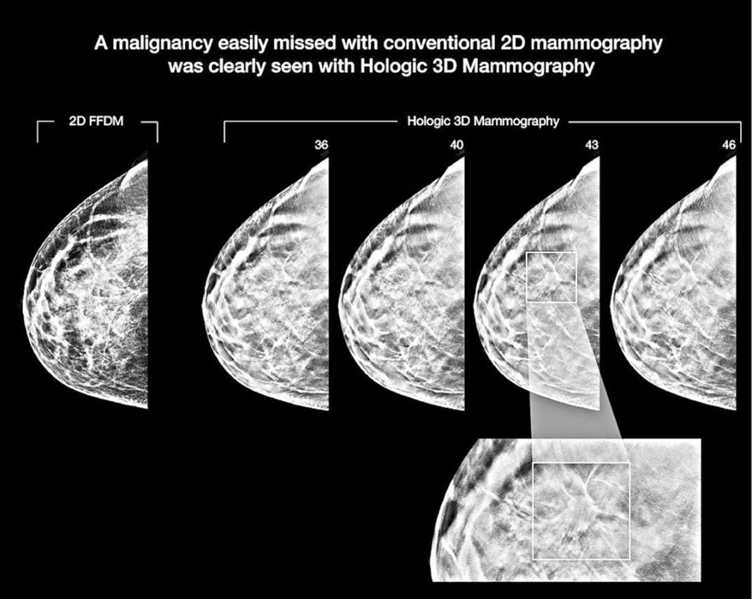 Mammograms Are Better In 3D – Family Medicine Center – Bahamas