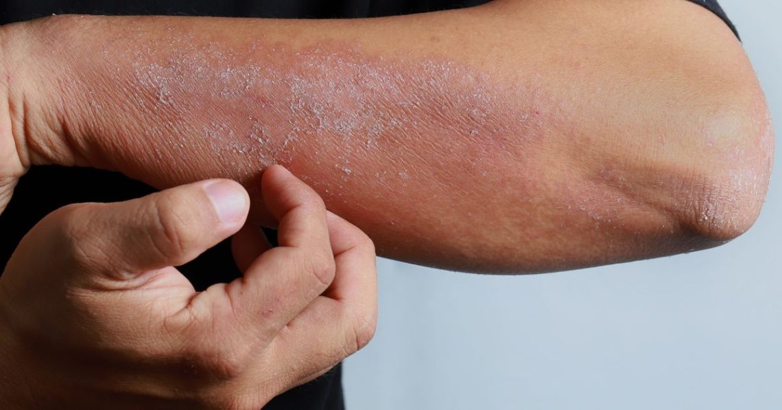 10 Signs Your Digestive System Needs Attention – Family Medicine Center ...