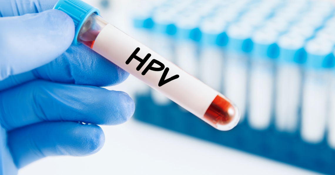 Understanding Pap Smears and HPV Tests – Family Medicine Center – Bahamas